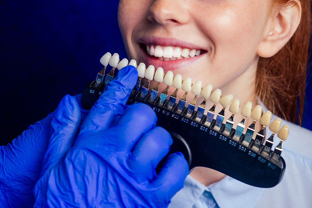 Metalokeramičke krunice | Dental Čigota